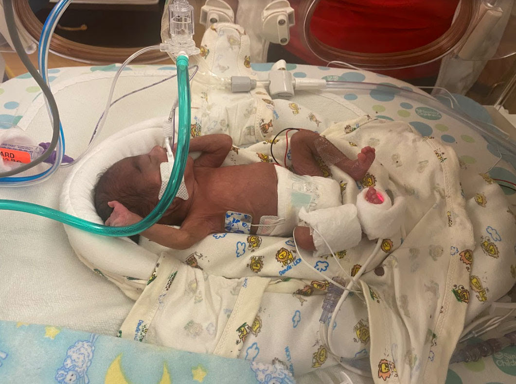 Adquipment medical b.v.; positioneren pasgeborenen DandleLION - Medassort